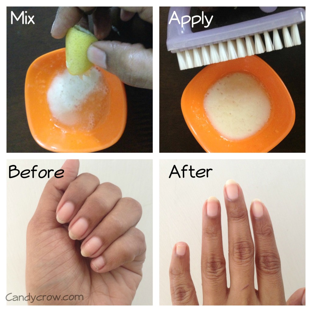 How to Get Rid of Yellow Nails by Home Remedies - StyleGlow.com